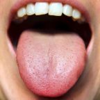 Gele Tong Aanslag? | 7 Nadelen + Tips (MustRead)